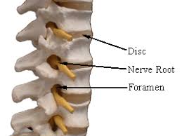 Cervical Nerve Root Blocks - Best Pain Doctor NYC
